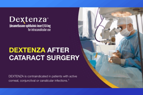 New Dextenza Reduces the Drop Regimen after Cataract Surgery