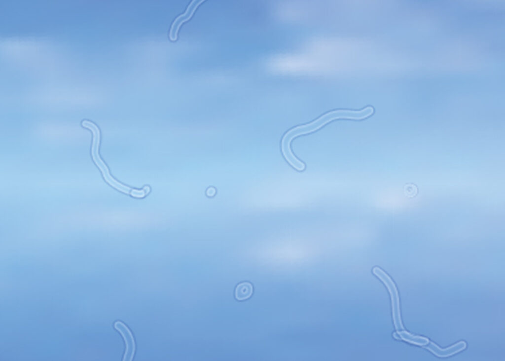 Flashes and Floaters - Eye Surgeons Associates